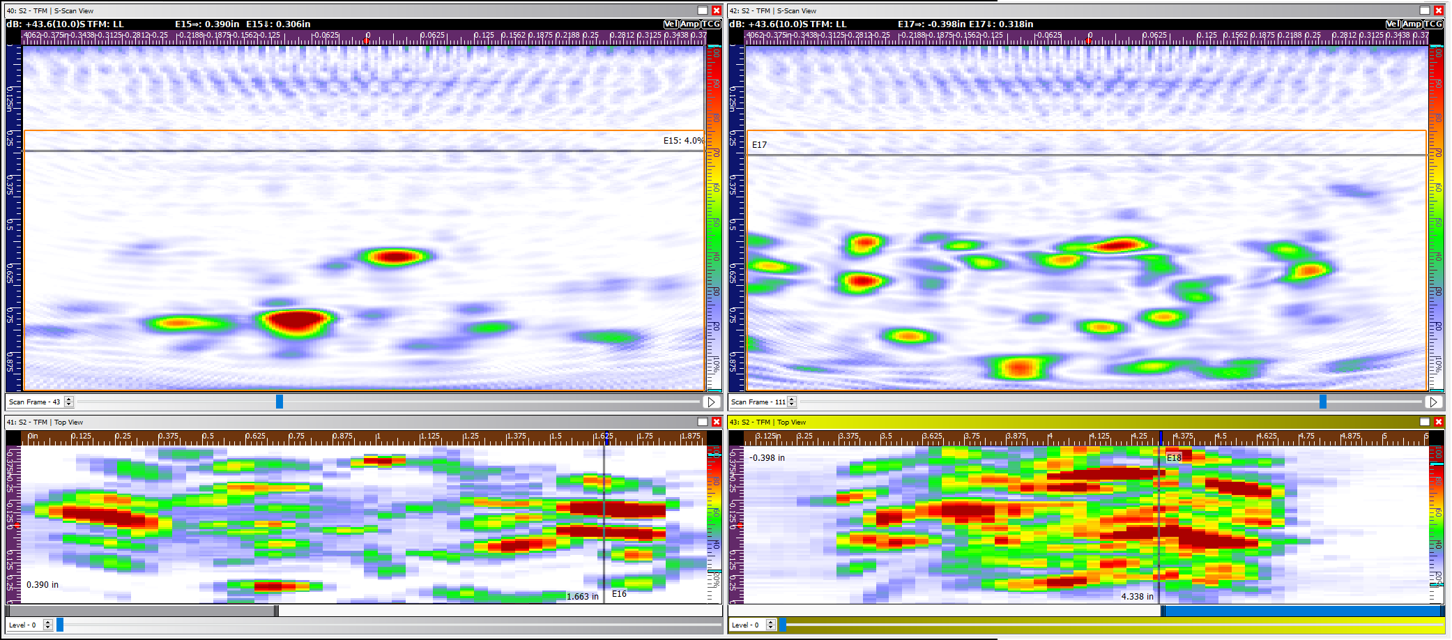 TFM/TFMi behaviour on Stage 2 & 3 HTHA : Sonatest